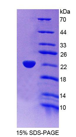 Acyl Coenzyme A Oxidase 3 (ACOX3), Recombinant Protein For Research Use ...