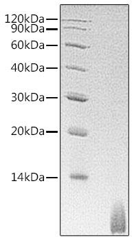 Polyubiquitin-B/UBB, Recombinant Protein For Research Use | High Purity ...