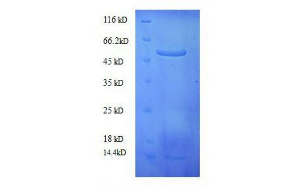 RuBisCO, Native Protein For Research Use | High Purity Product Use ...